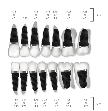 Dental gum surgery and implant - وبسایت رسمی کلینیک تخصصی دندانپزشکی ...